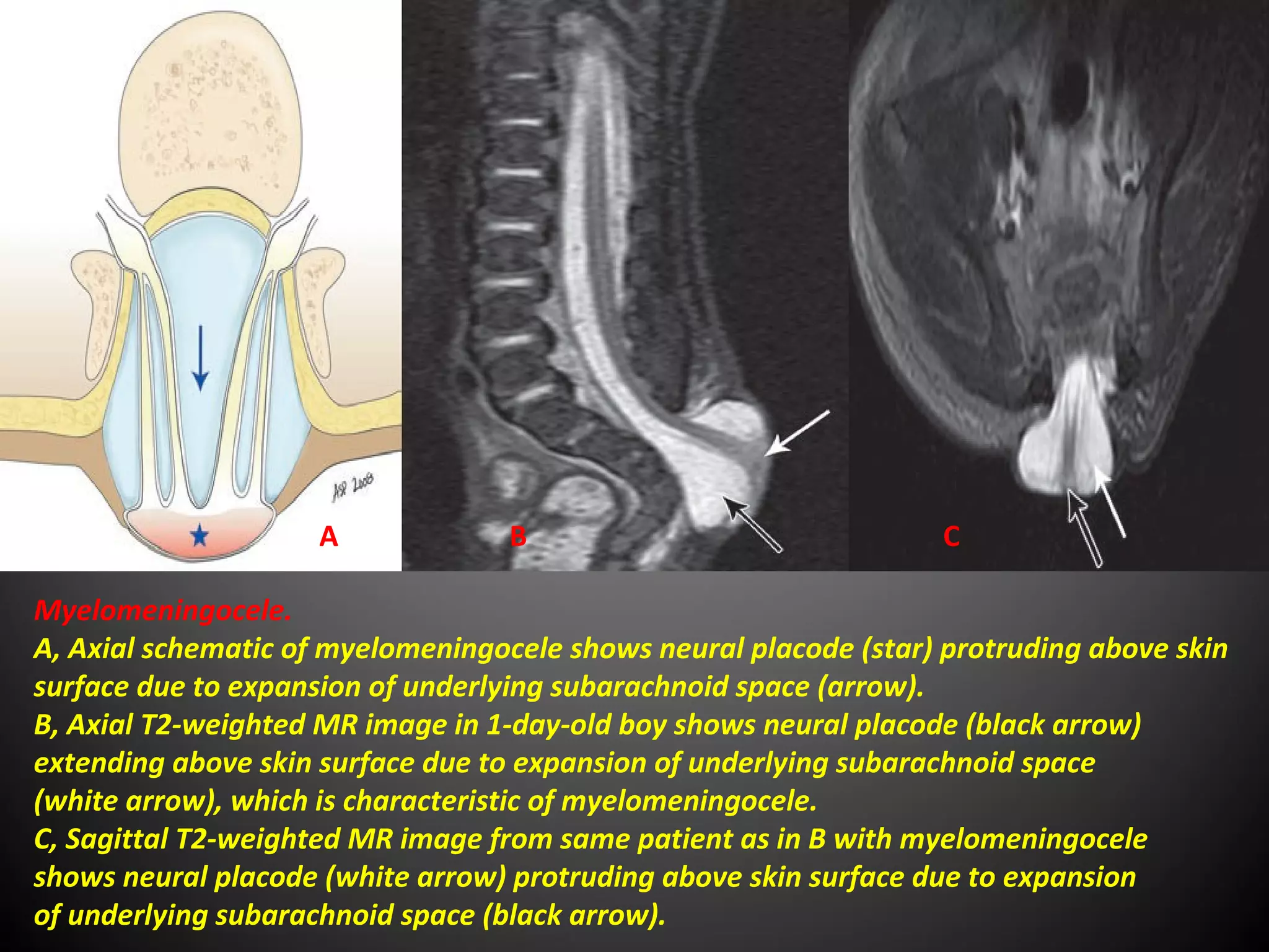 Radiological findings of congenital anomalies of the spine and spinal ...