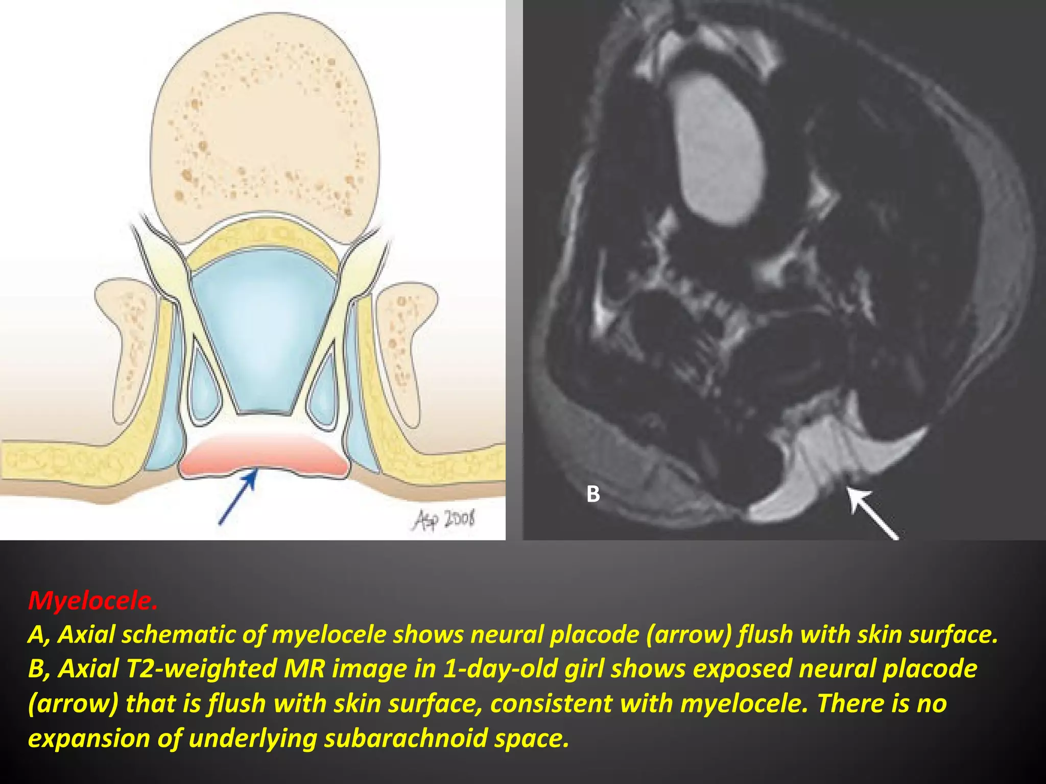 Radiological findings of congenital anomalies of the spine and spinal ...