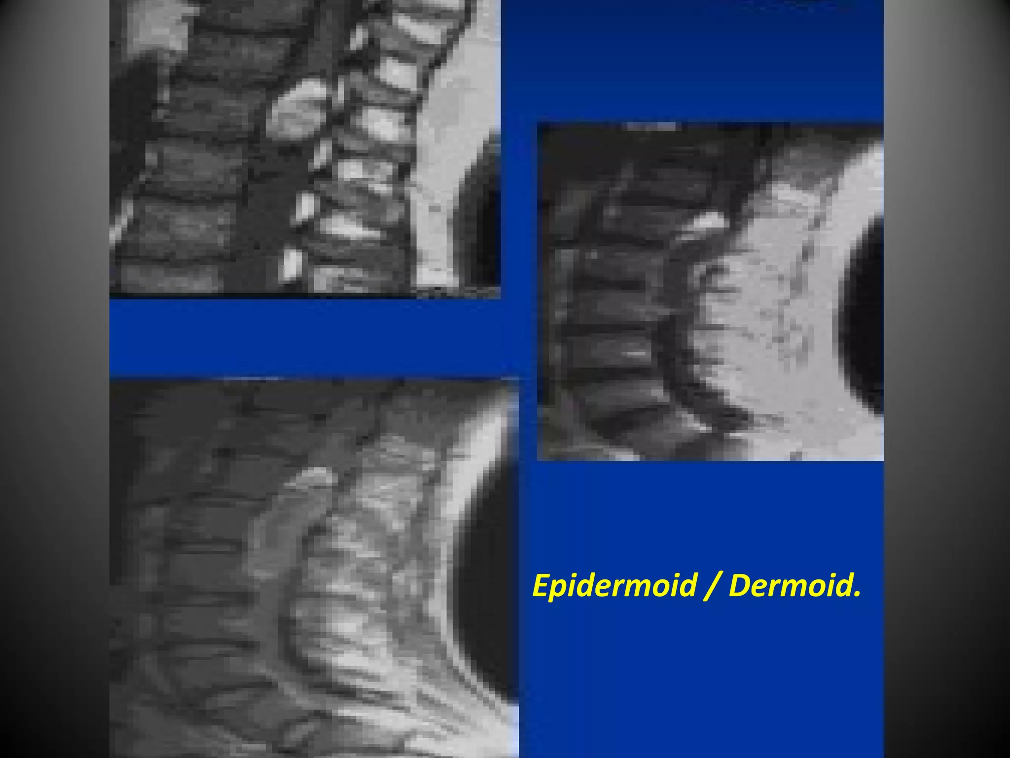 Radiological findings of congenital anomalies of the spine and spinal ...