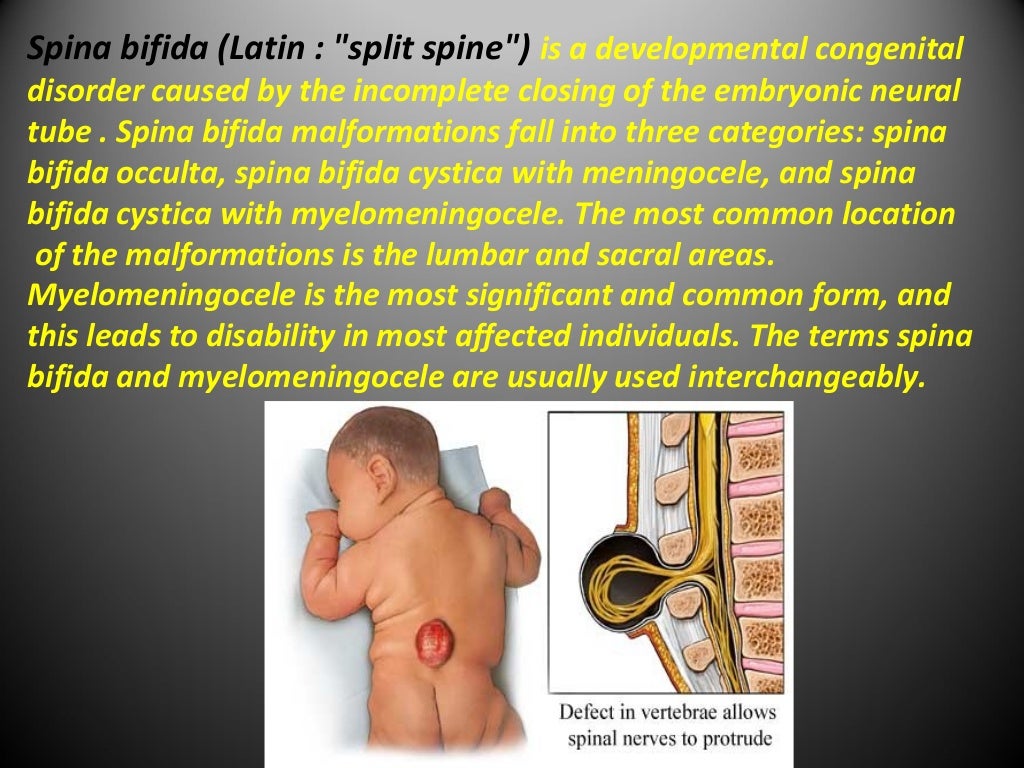 Radiological findings of congenital anomalies of the spine and spinal…