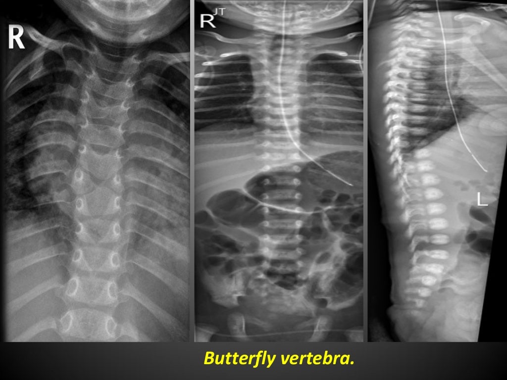 Congenital Anomalies