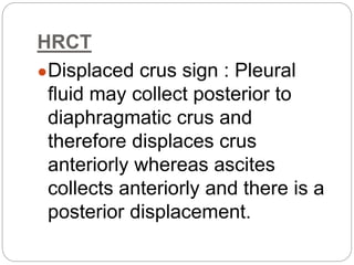 Radiological findings of pleural effussion | PPT