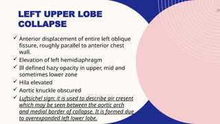 Radiological imaging of collapse vs consolidation vs fibrosis.pptx