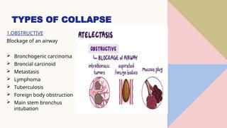 Radiological imaging of collapse vs consolidation vs fibrosis.pptx