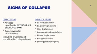 Radiological imaging of collapse vs consolidation vs fibrosis.pptx