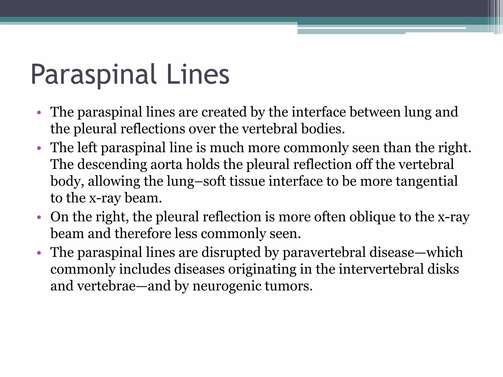 Radiological imaging of mediastinal masses | PPTX