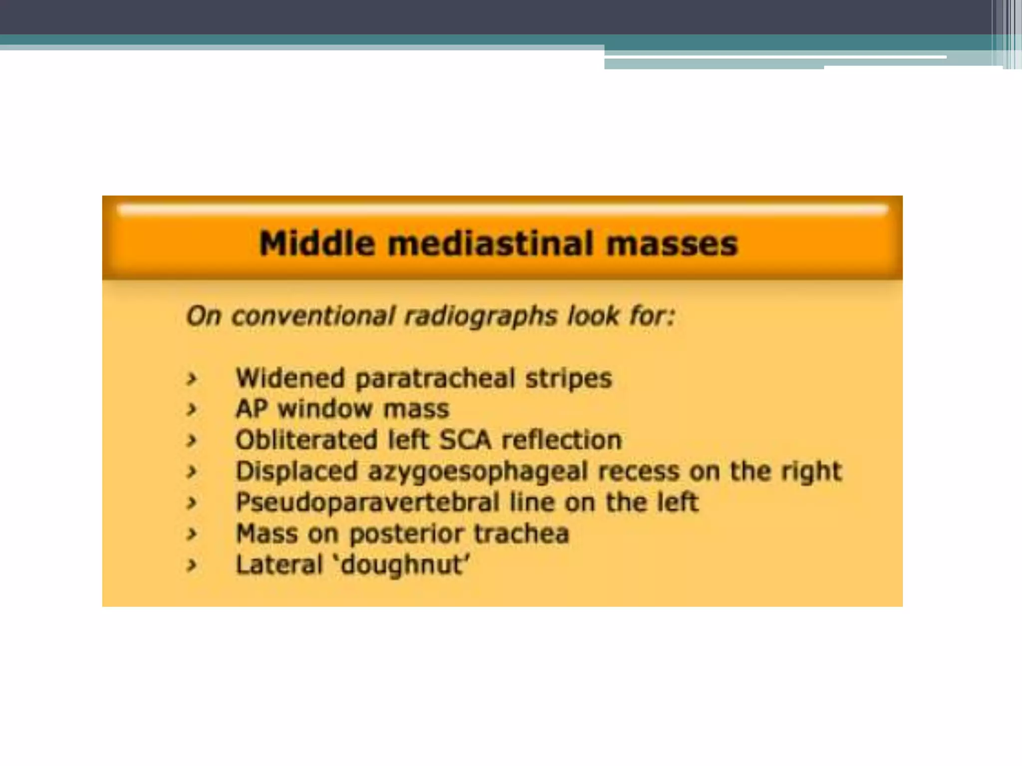 Radiological imaging of mediastinal masses | PPTX