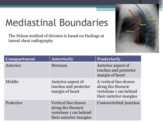 Radiological imaging of mediastinal masses