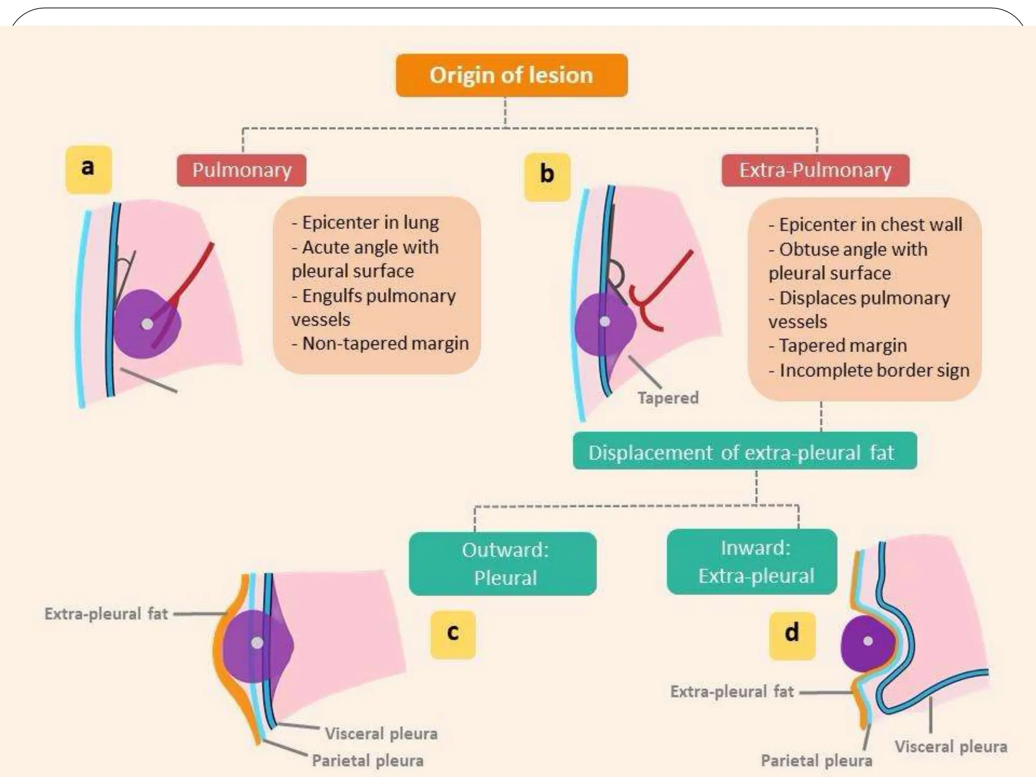 radiologicalimagingofpleuraldiseases2-170304105616.pptx