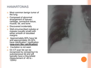 Radiological imaging of pulmonary neoplasms | PPTX
