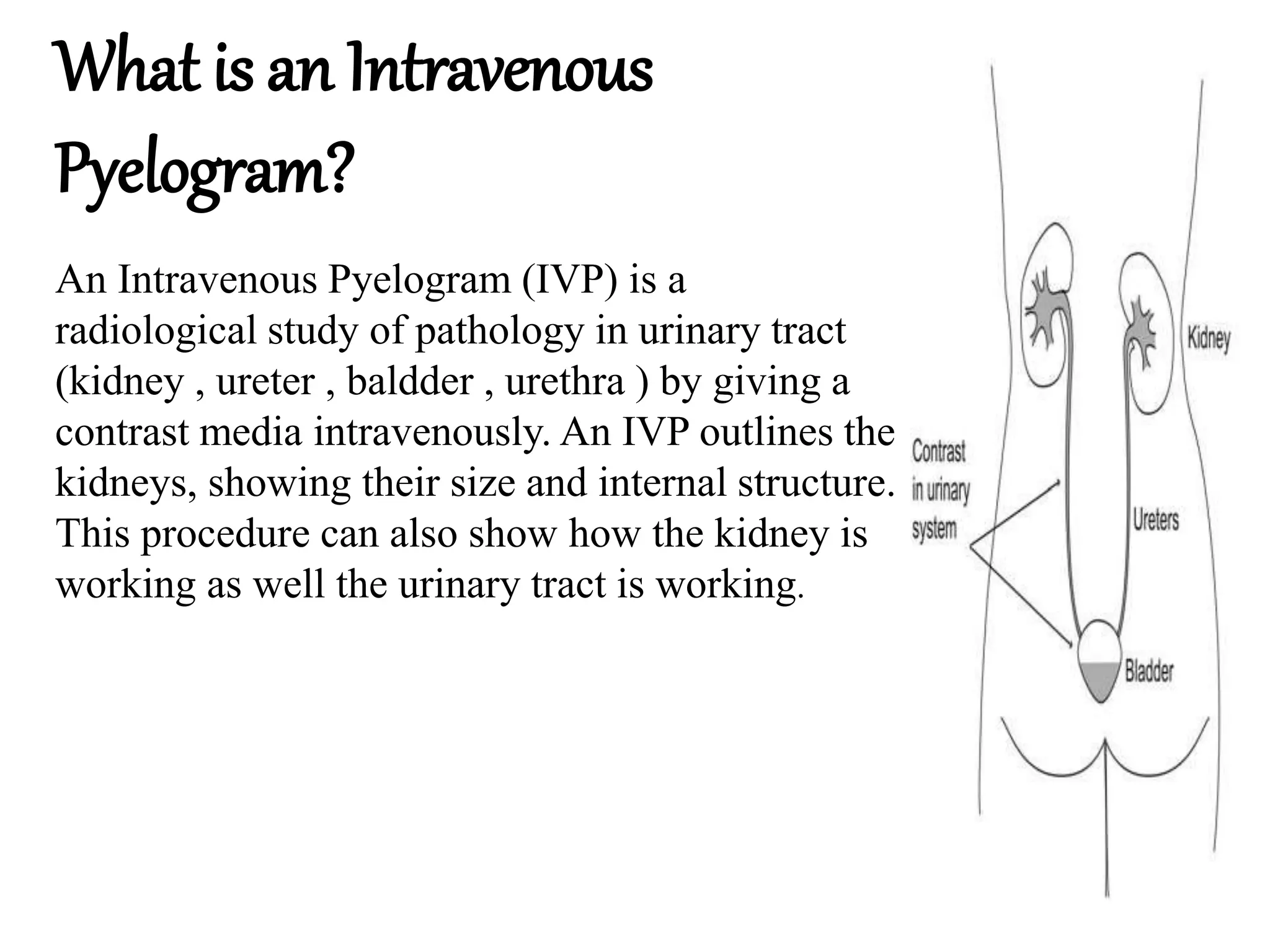 Radiological importance of intravenous pyelography | PPTX