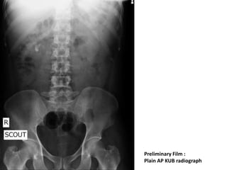 Radiological importance of intravenous pyelography | PPTX