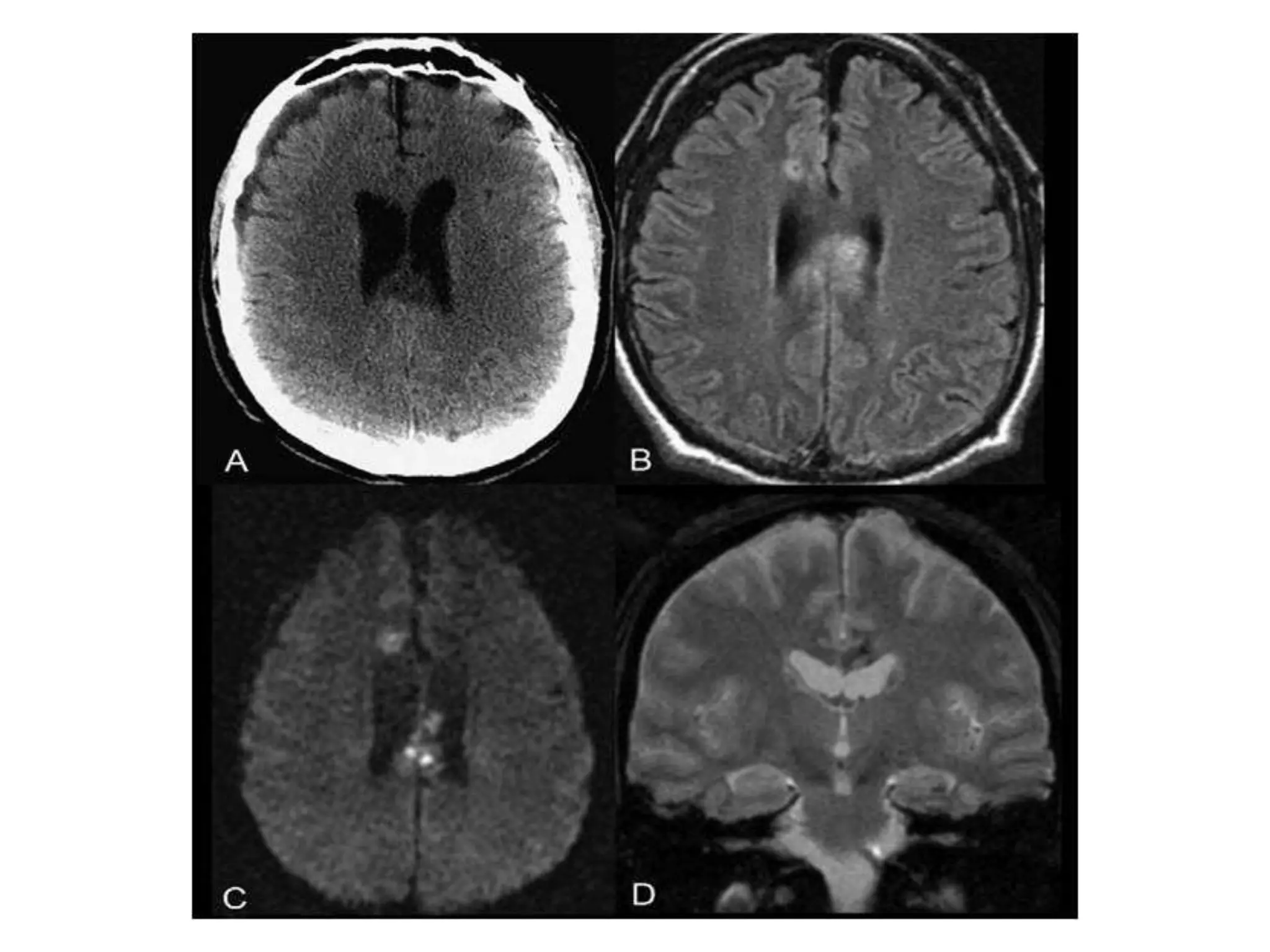 Radiological Investigations for Neuro Trauma | PPT Radiological Investigations for Neuro Trauma | PPT