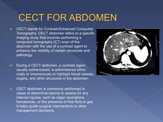 RADIOLOGICAL INVESTIONS IN A TRAUMA VICTIM_113032.pptx