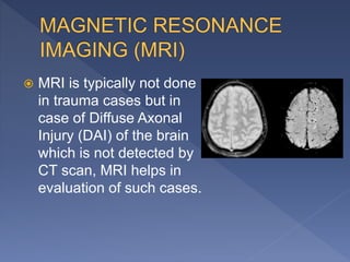 RADIOLOGICAL INVESTIONS IN A TRAUMA VICTIM_113032.pptx