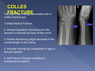 RADIOLOGICAL INVESTIONS IN A TRAUMA VICTIM_113032.pptx