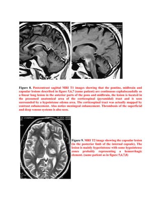 Topic of the month: Radiological pathology of behcet disease | PDF