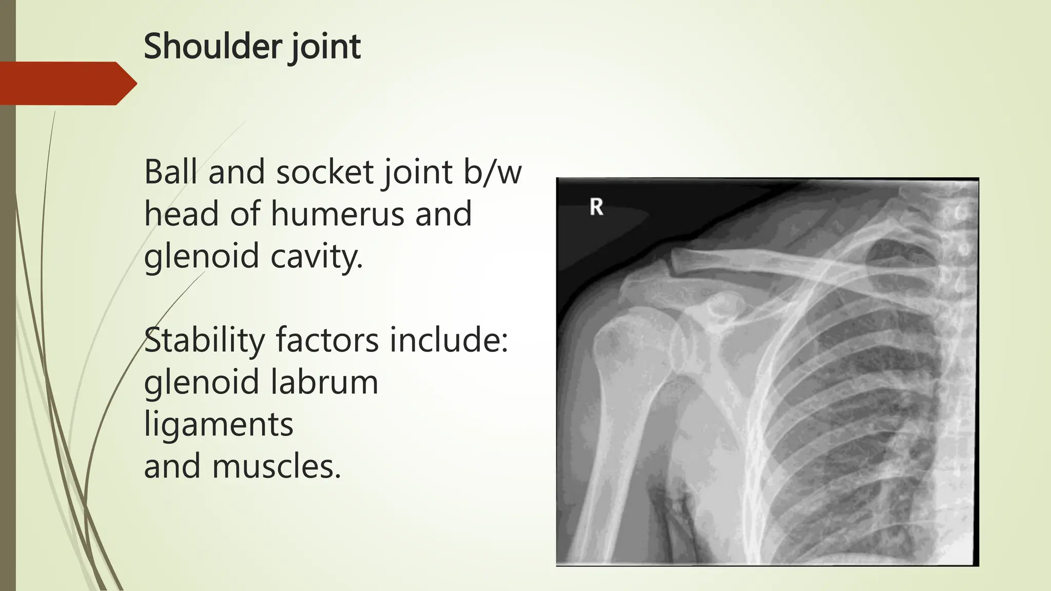 Radiological presentation fractures.pptx | Death, Injury, or Military ...