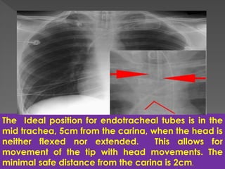 Radiological Presentation of Pulmonary Pathology | PDF
