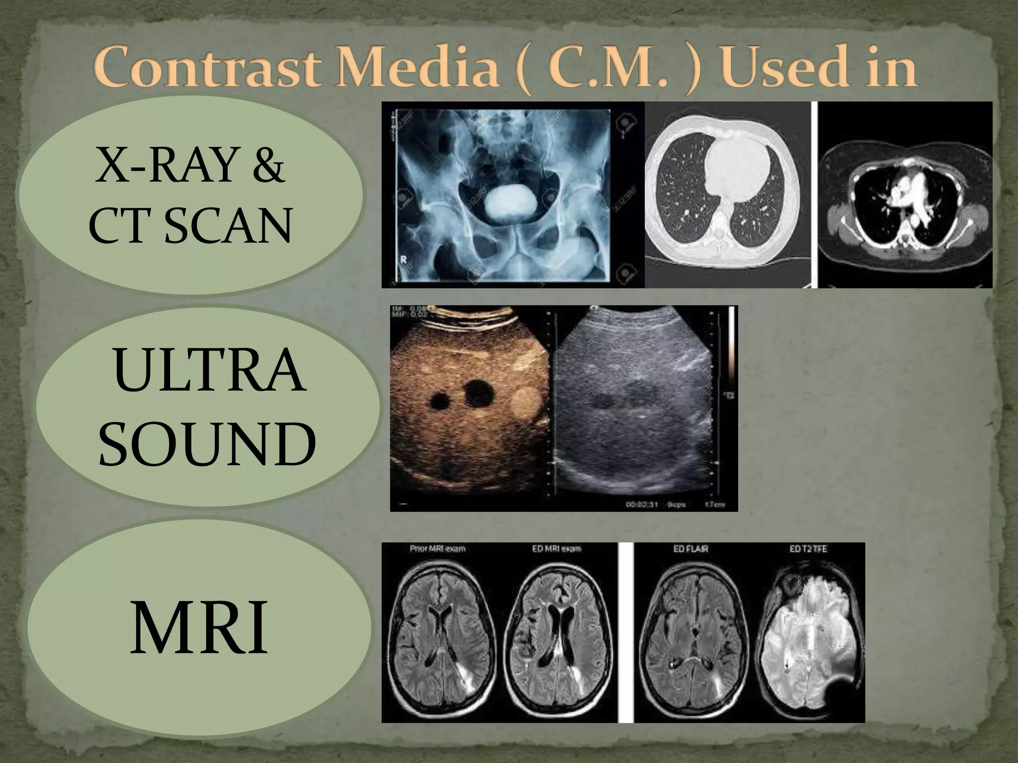 Radiological procedure CONTRAST MEDIA | PPTX