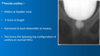 Radiological Procedure of Retrograde Urethrography.pptx