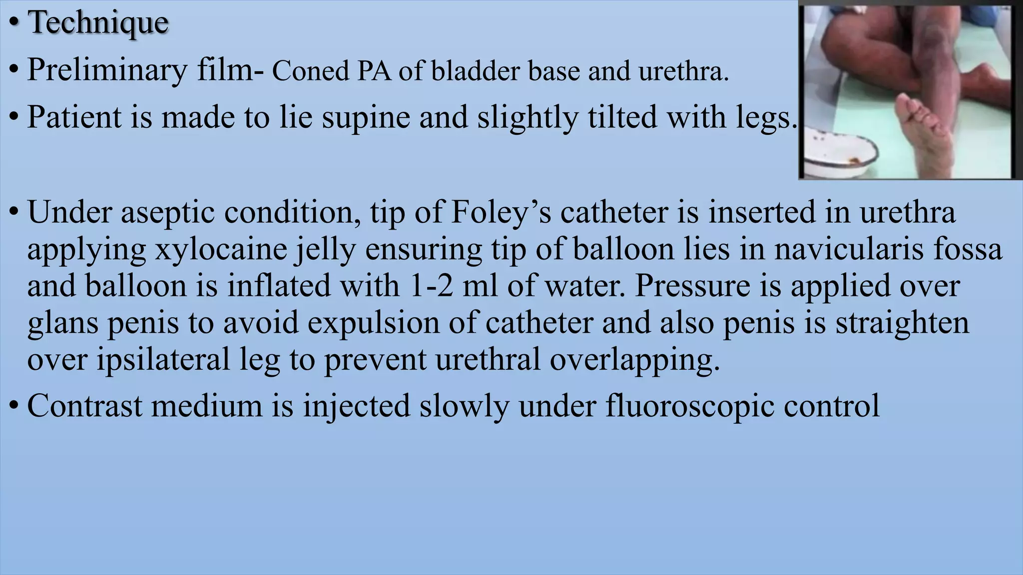 Radiological procedure of retrograde urethrography(rgu) and micturating ...