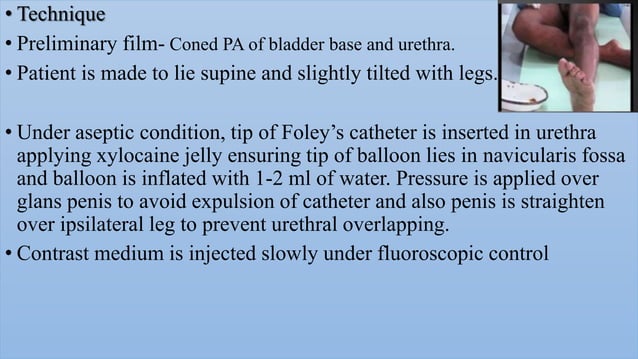 Radiological procedure of retrograde urethrography(rgu) and micturating | PPTX | Sexual ...