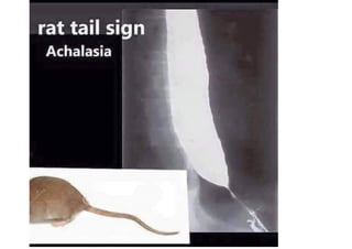 Radiological signs | PDF