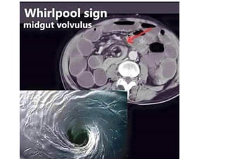 Radiological signs | PDF