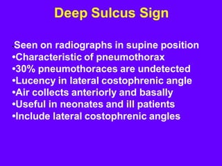Radiological signs in chest medicine | PDF