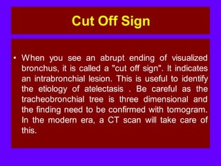Radiological signs in chest medicine | PPT