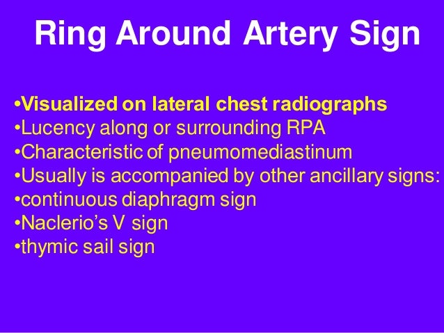 Radiological signs in chest medicine