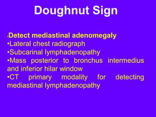 Radiological Signs in Chest Medicine | PPT
