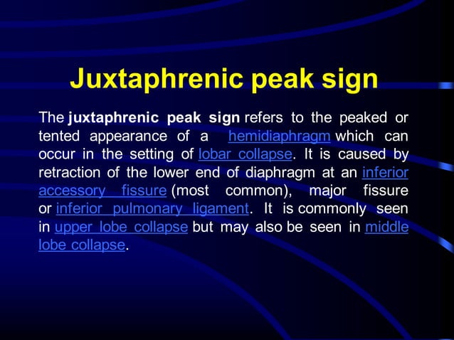 Radiological signs in chest medicine Part 1 | PDF