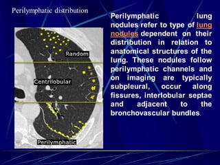 Radiological signs in chest medicine Part 1 | PDF
