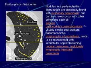 Radiological signs in chest medicine Part 1 | PDF