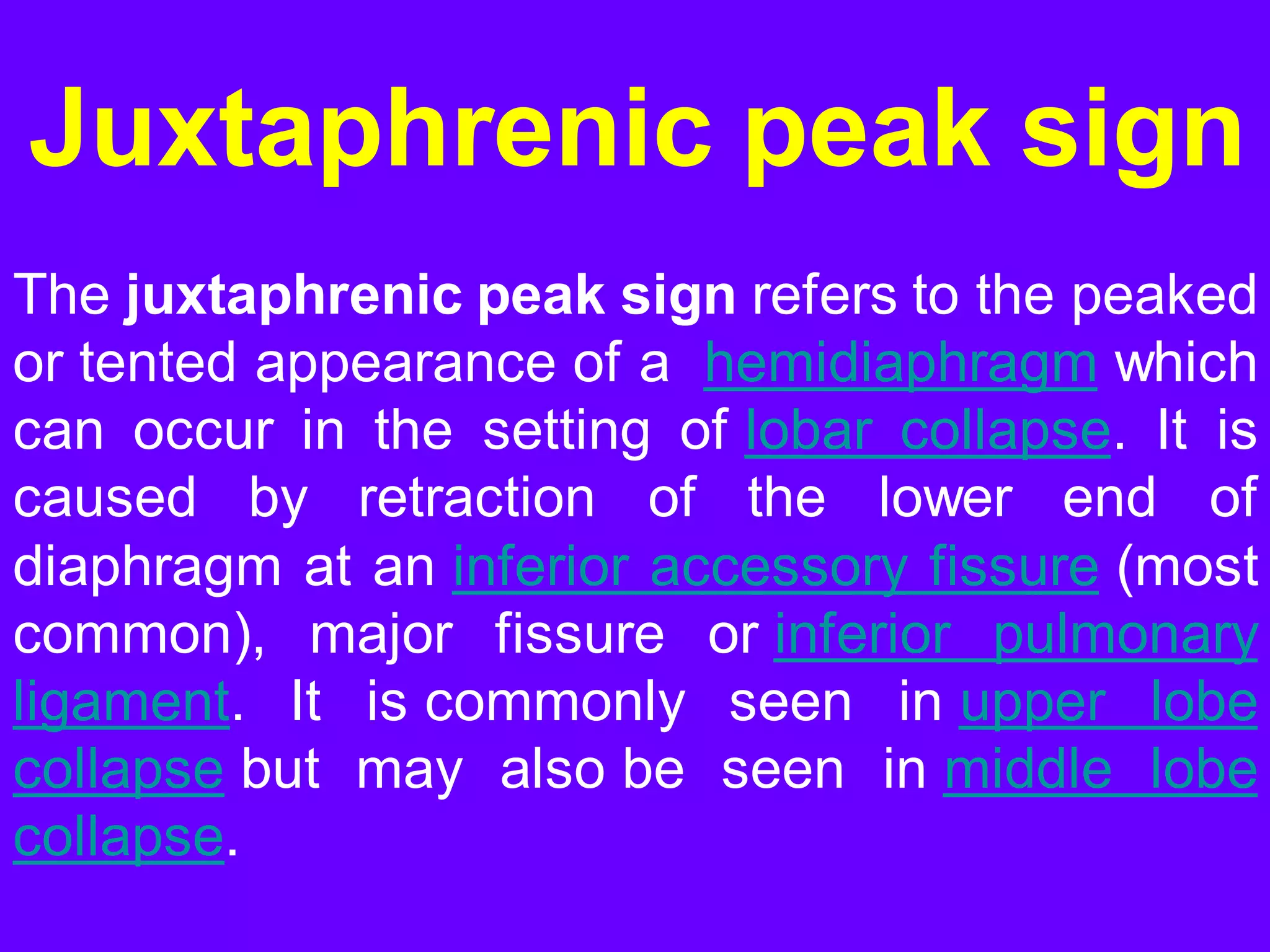 Radiological signs in chest medicine part 2 | PDF
