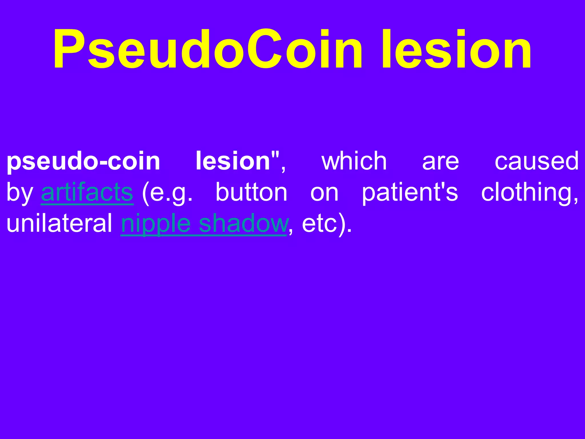 Radiological signs in chest medicine part 2 | PDF