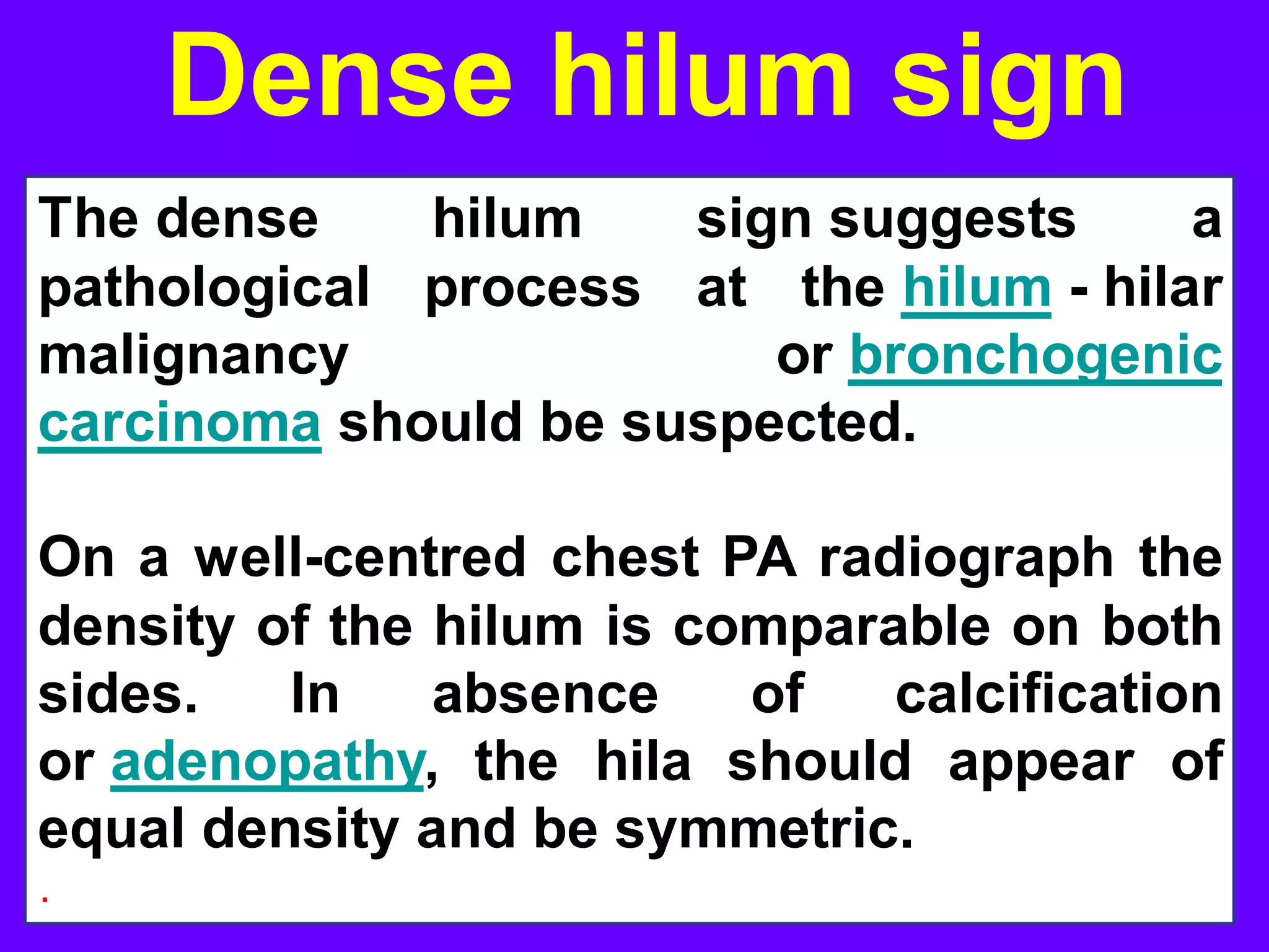 Radiological signs in chest medicine part 2 | PDF