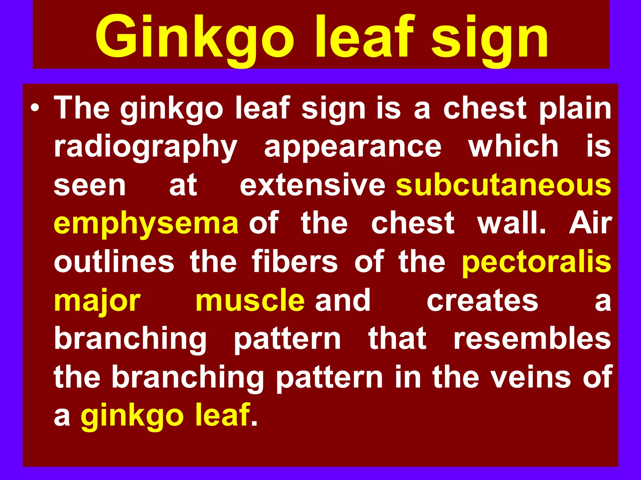 Radiological signs in chest medicine part 2 | PDF