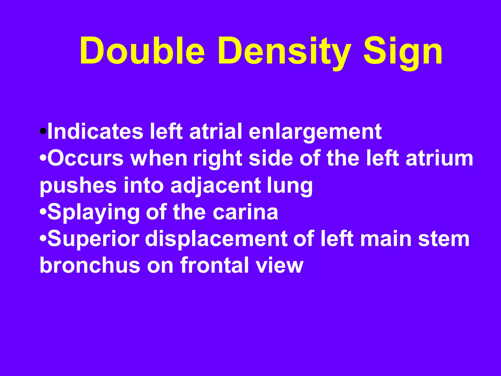 Radiological signs in chest medicine part 2 | PDF