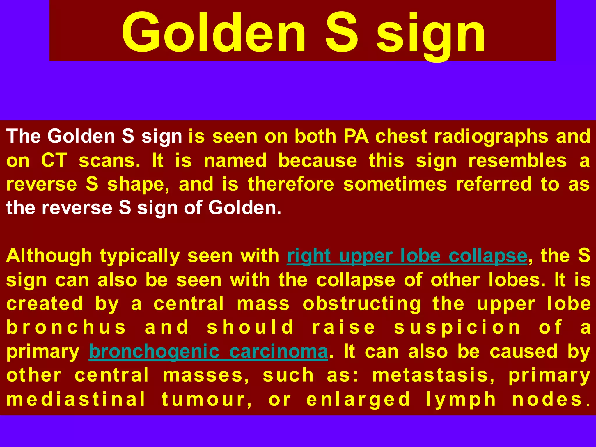 Radiological signs in chest medicine part 2 | PDF