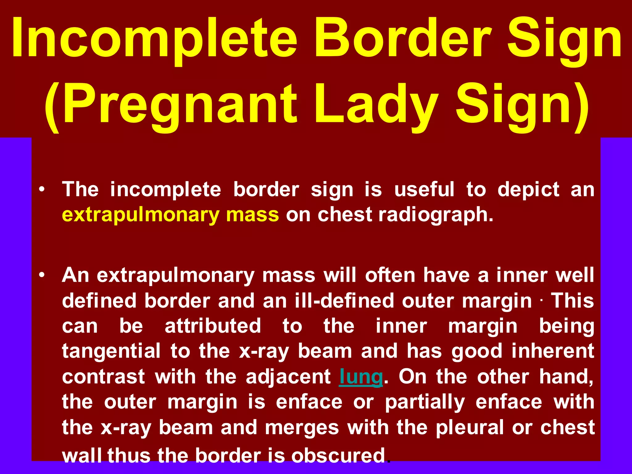 Radiological signs in chest medicine part 2 | PDF