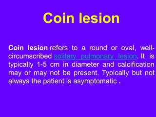 Radiological signs in chest medicine part 2 | PDF
