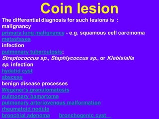 Radiological signs in chest medicine part 2 | PDF