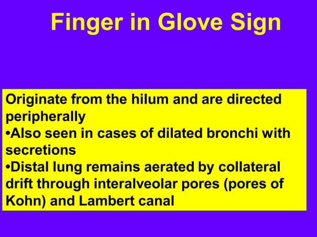 Radiological signs in chest medicine part 2 | PDF | Lung and ...