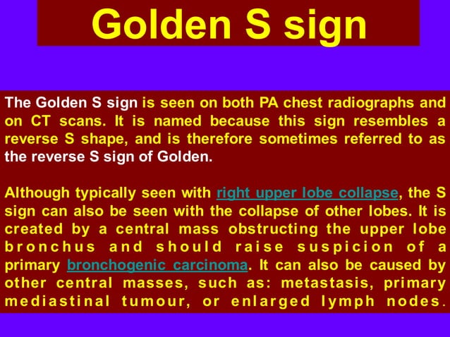 Radiological signs in chest medicine part 2 | PDF | Lung and ...