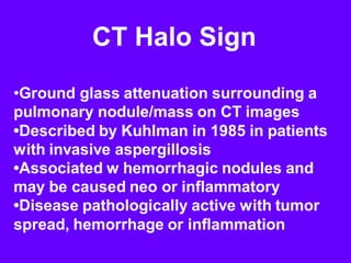 Radiological signs in chest medicine part 2 | PDF