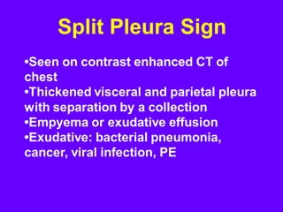 Radiological signs in chest medicine part 2 | PDF