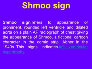 Radiological signs in chest medicine part 2 | PPT